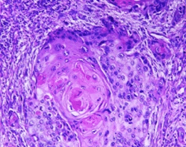 Tissue Analysis with AI and Deep Learning by RSIP Vision