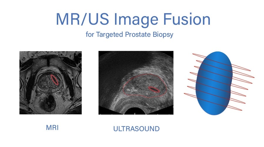 Ultrasound Archives - RSIP Vision